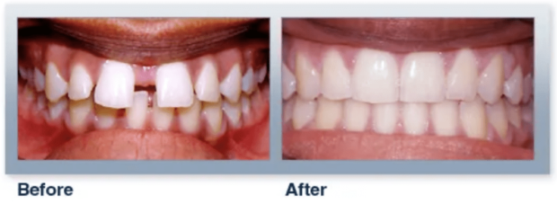 Orthodontist in Brooklyn, NY - Smile Gallery Brooklyn Heights ...